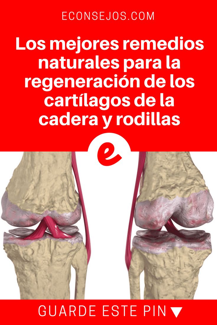 Rodillas dolor | Los mejores remedios naturales para la regeneración de ...